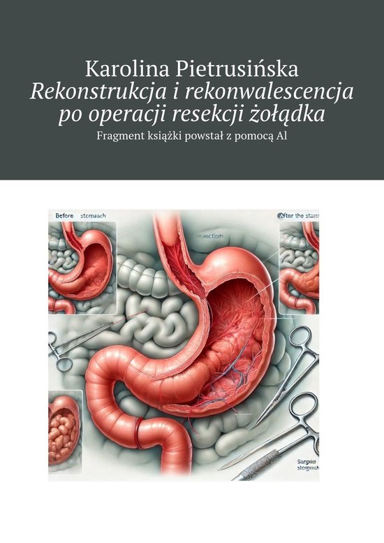 Rekonstrukcja i rekonwalescencja po operacji resekcji żołądka (ebook ...