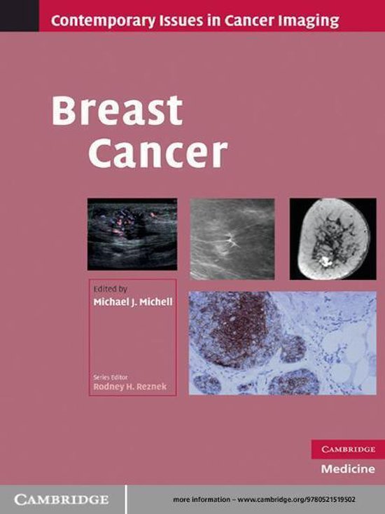 Contemporary Issues in Cancer Imaging - Breast Cancer (ebook ...
