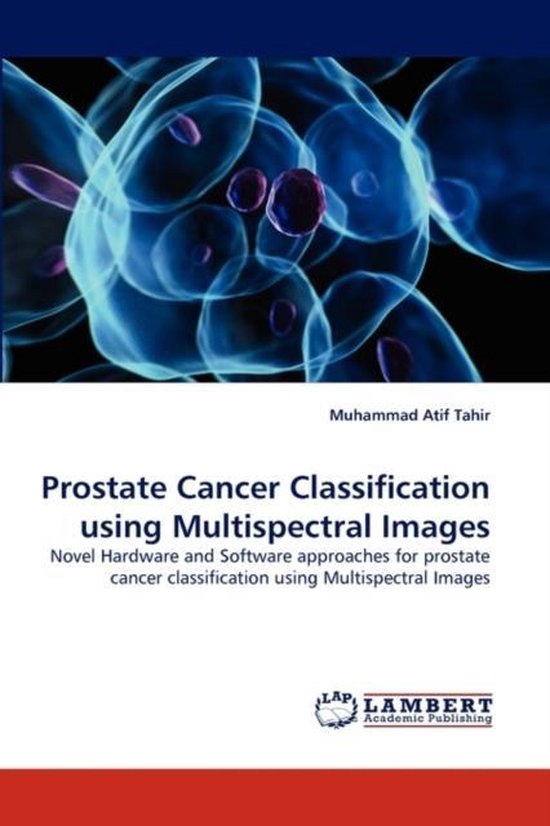 Prostate Cancer Classification using Multispectral Images ...