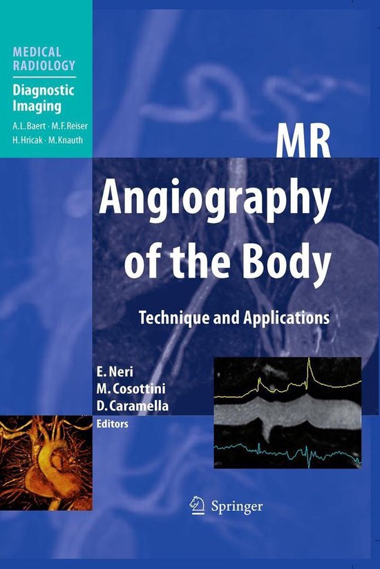 Medical Radiology - MR Angiography of the Body (ebook) | 9783540797173 ...
