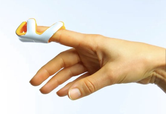 Arch CoreLife Vingerbevestigingsspalk | Kikker Vingerbrace | Sportbrace ...