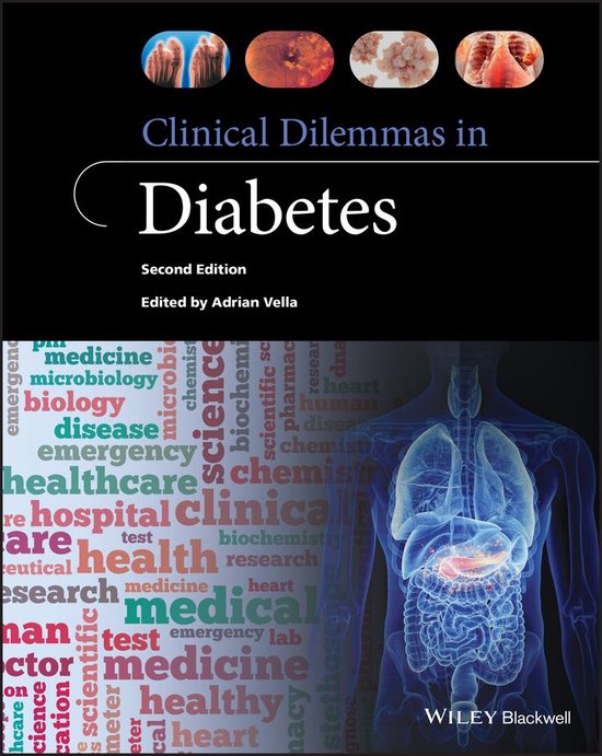 Clinical Dilemmas (UK) - Clinical Dilemmas in Diabetes (ebook), Adrian ...