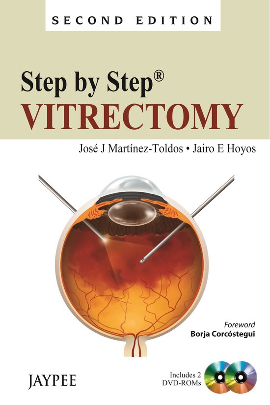 Step By Step: Vitrectomy | 9789350903544 | Jose J Martinez-Toldos ...
