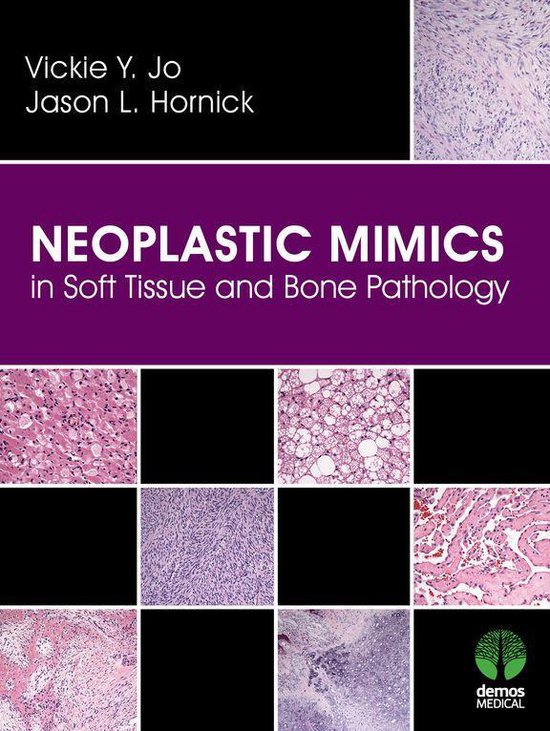 Pathology of Neoplastic Mimics - Neoplastic Mimics in Soft Tissue and ...