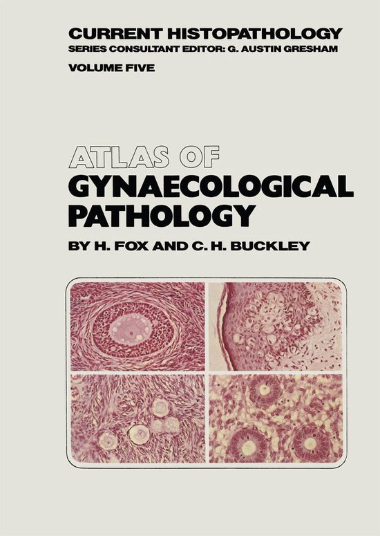 Current Histopathology 5 - Atlas of Gynaecological Pathology (ebook), H ...