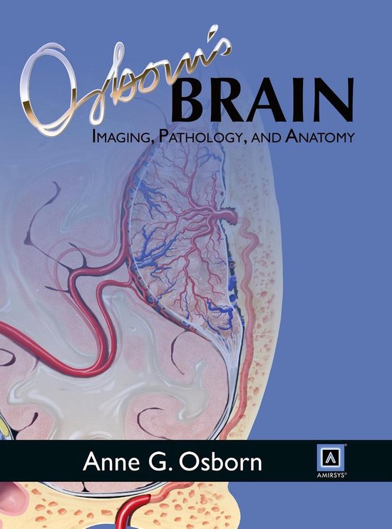 Osborn's Brain | 9781931884211 | Anne G. Osborn | Boeken | bol.com
