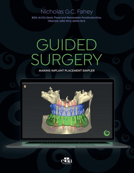 GUIDED SURGERY (ebook), Nicholas G.C. Fahey | 9781957260952 | Boeken | bol