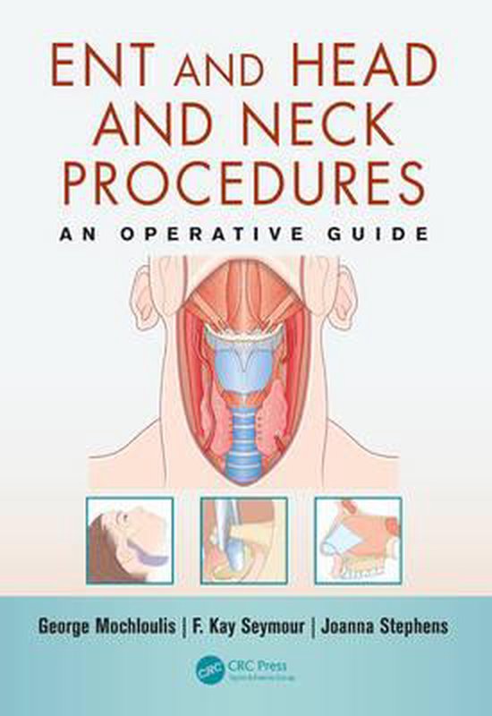 ENT & Head & Neck Procedures | 9781840761962 | F. Kay Seymour | Boeken ...