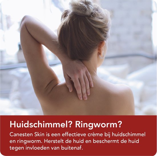 Canesten Skin Crème - Tegen huidschimmel, ringworm en gistinfecties ...