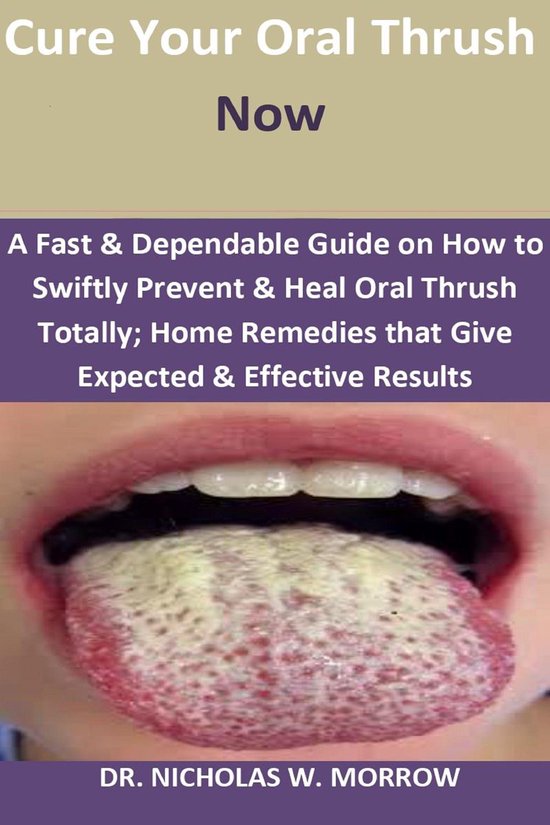 Cure Your Oral Thrush Now (ebook), Andrew Odokuma | 1230003936986 ...