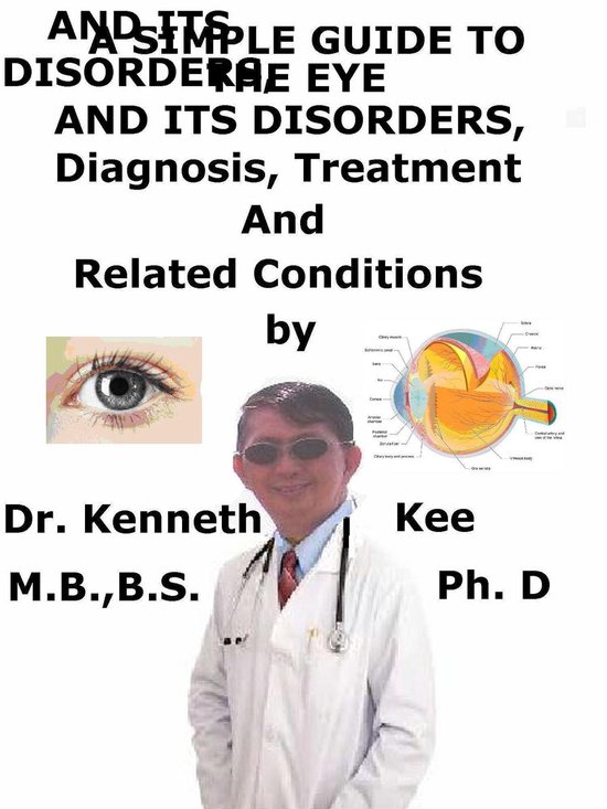A Simple Guide to the Eye and Its Disorders, Diagnosis, Treatment and ...
