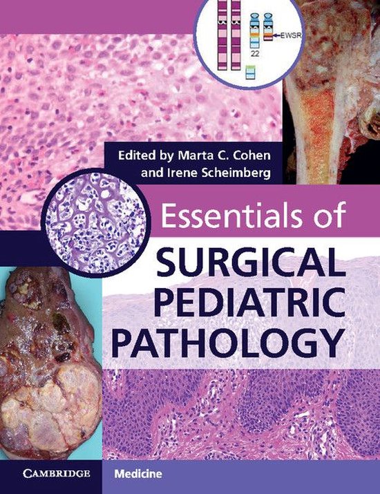 Essentials of Surgical Pediatric Pathology (ebook) | 9781316120880 ...