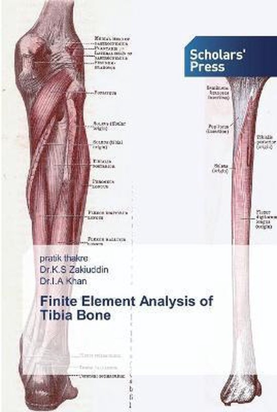 Finite Element Analysis of Tibia Bone | 9786138918240 | Pratik Thakre ...
