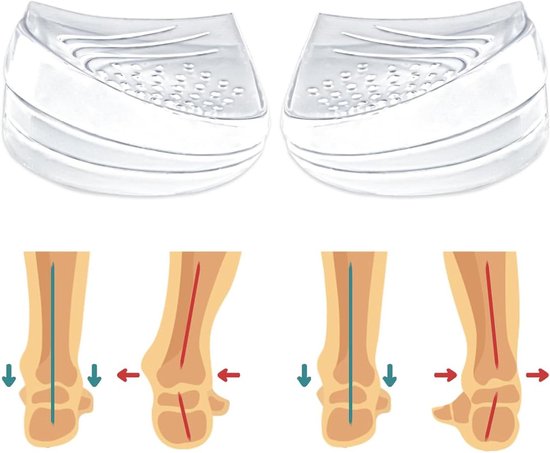 Heel Wedge Insoles - Adjustable Inserts for Supinations Pronation ...