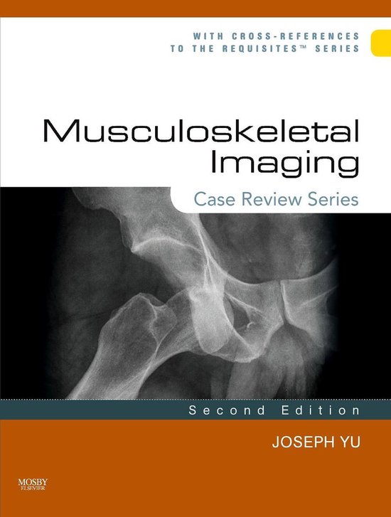 Musculoskeletal Imaging | 9780323052429 | Joseph Yu, Md | Boeken | bol.com