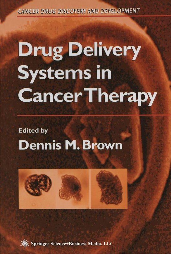 Cancer Drug Discovery and Development - Drug Delivery Systems in Cancer ...