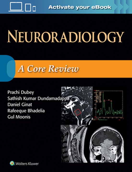 Neuroradiology | 9781496372505 | Prachi Dubey | Boeken | bol.com