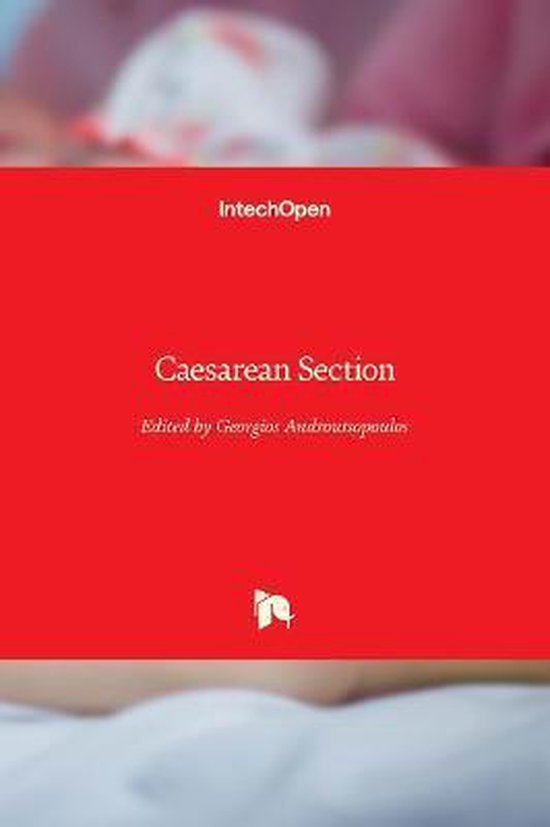 Caesarean Section | 9781789239317 | Boeken | bol.com