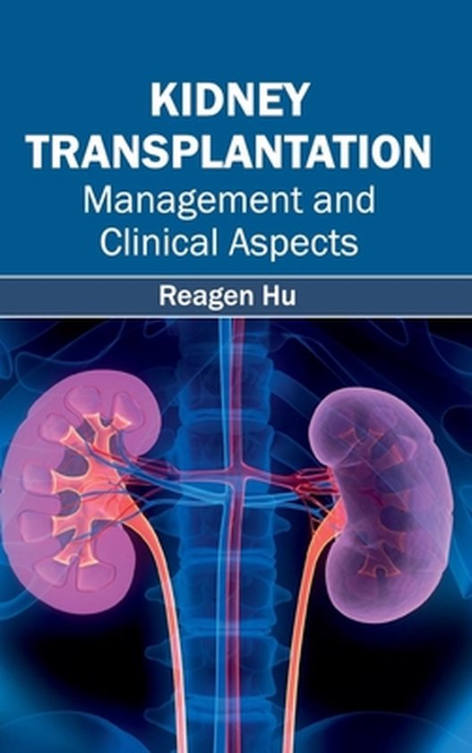 Kidney Transplantation | 9781632412751 | Boeken | bol.com