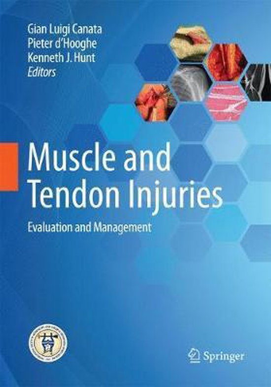 Muscle and Tendon Injuries | 9783662571859 | Gian Luigi Canata | Boeken ...