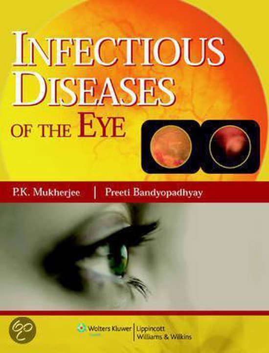 Infectious diseases of the Eyes | 9788184731989 | P. K. Mukherjee ...