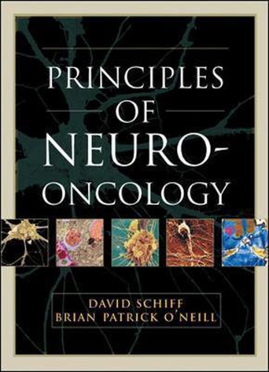 Principles of Neuro-Oncology | 9780071425155 | David Schiff | Boeken | bol.com