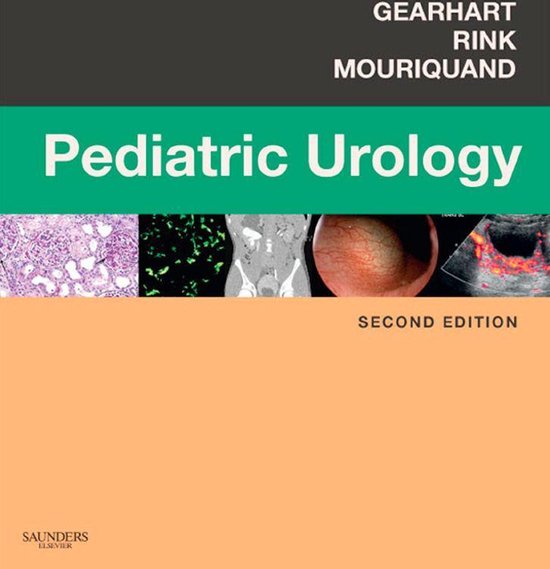 Pediatric Urology E-Book (ebook), John G. Gearhart, Md, Facs ...