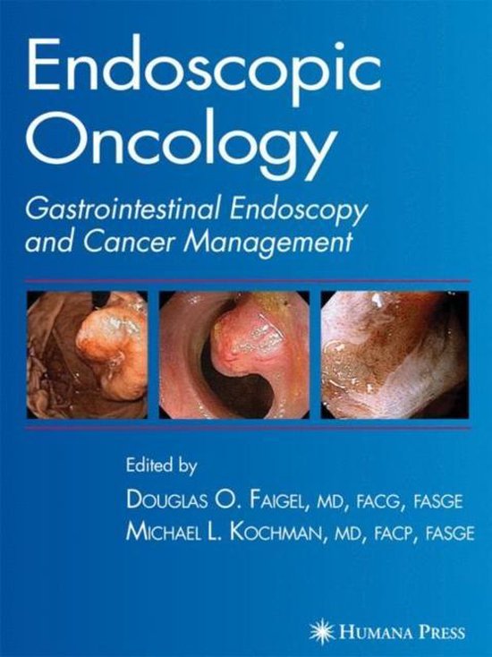 Endoscopic Oncology | 9781588295323 | Michael L. Kochman | Boeken | bol
