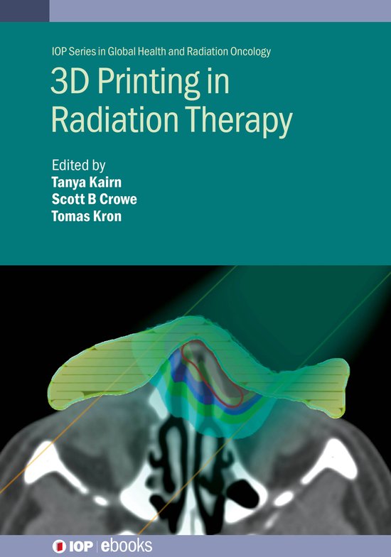 3D Printing in Radiotherapy | 9780750339056 | Tomas Kron | Boeken | bol