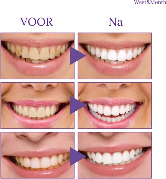 West & Month V34 - Paarse Tandpasta - Colour Corrector Serum - Witte Tanden - Teeth... | bol