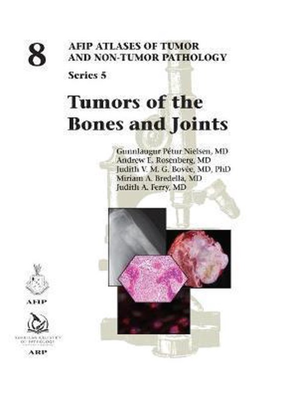 AFIP Atlases of Tumor and Non-tumor Pathology, Series 5- Tumors of the Bones and... | bol