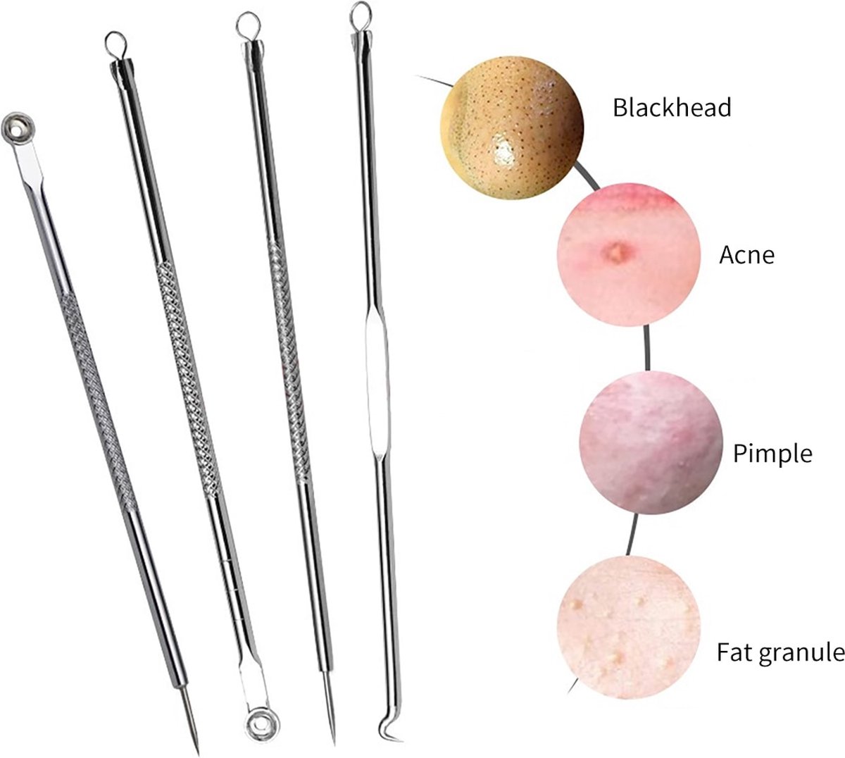 DecoDuoBelle - Mee-eters verwijderen - Blackhead remover - Puistjes ...