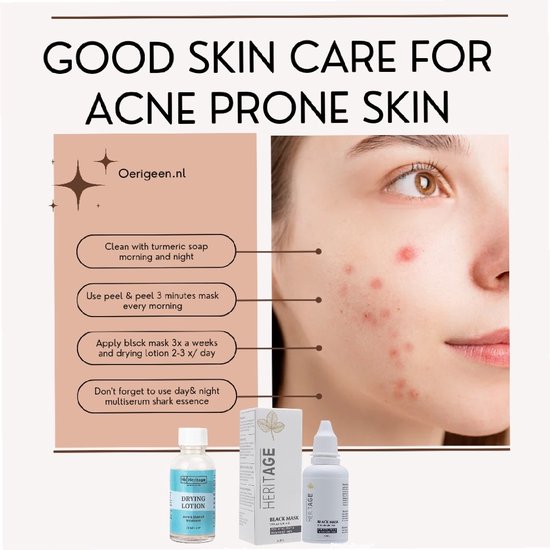 Acne SOS Kit set – Black Mask & Drying Lotion – Snelle ...