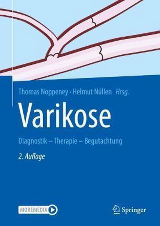 Varikose | 9783662591161 | Boeken | bol.com