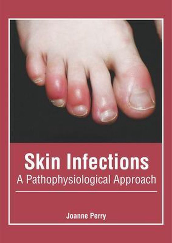Skin Infections | 9781632426185 | Boeken | bol.com