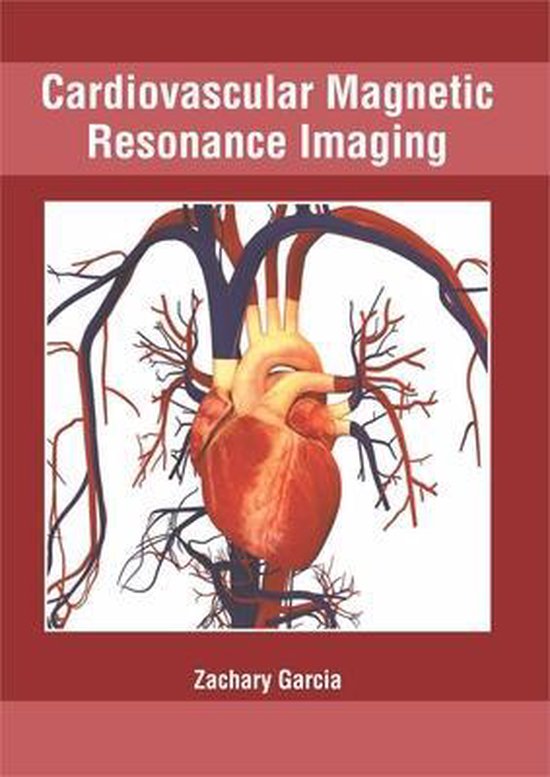 Cardiovascular Magnetic Resonance Imaging | 9781632426031 | Boeken | bol