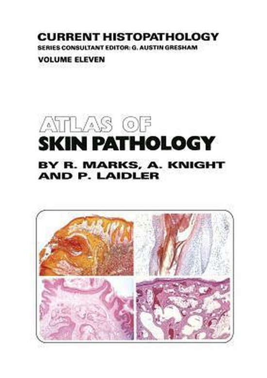 Atlas of Skin Pathology | 9789401083300 | R.M. Marks | Boeken | bol.com