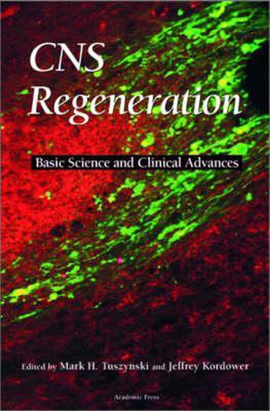 CNS Regeneration | 9780127050706 | Mark Tuszynski | Boeken | bol