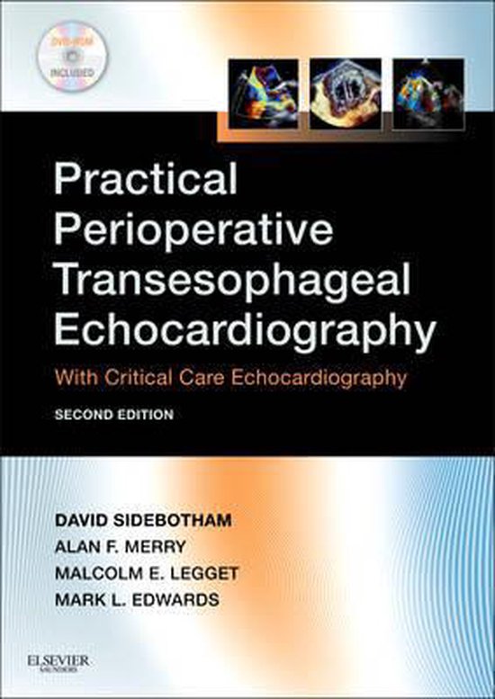 Practical Perioperative Transesophageal Echocardiography | 9780702034275 | David... | bol.com