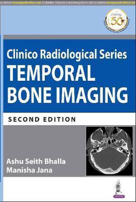 Clinico Radiological Series: Temporal Bone Imaging | 9789390020737 | Ashu Seith Bhalla... | bol