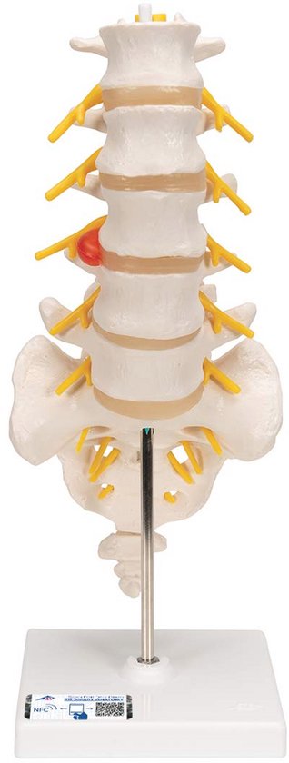Menselijke anatomie model lumbale wervelkolom met tussenwervelschijf en ...