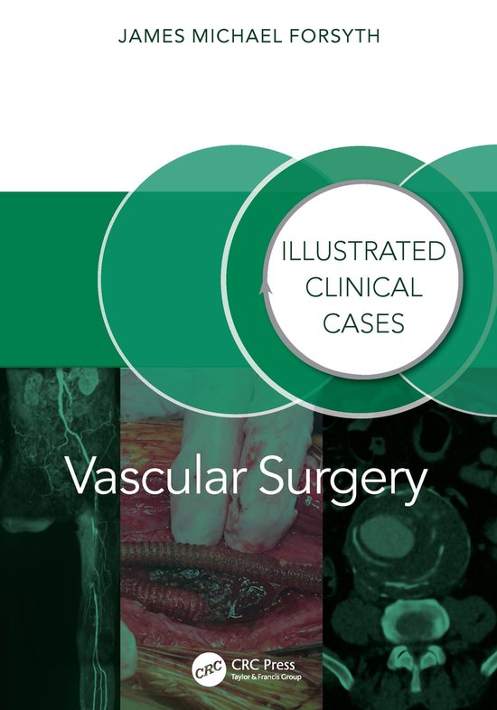 Illustrated Clinical Cases- Vascular Surgery: | 9781032804828 | James ...