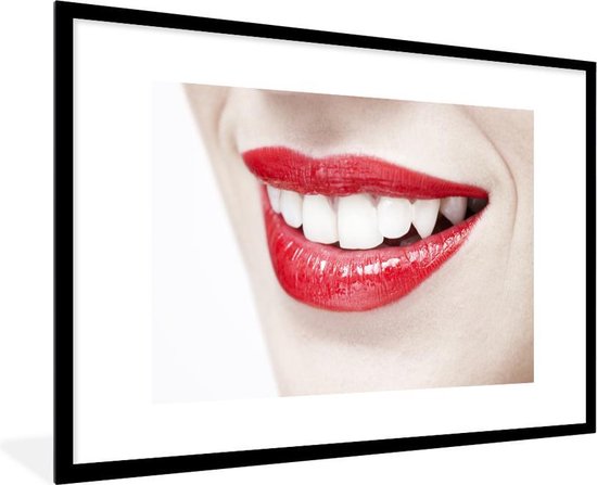 Fotolijst incl. Poster - Een afbeelding van rode lippen met witte ...