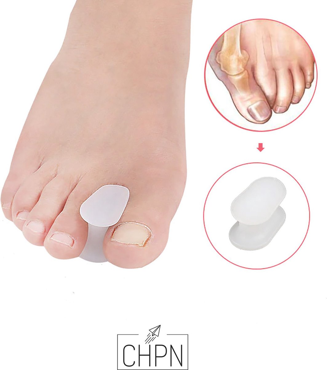 Teenspreider - Teenspreiders - Teenpijn - Hamerteen - Teen correctie ...