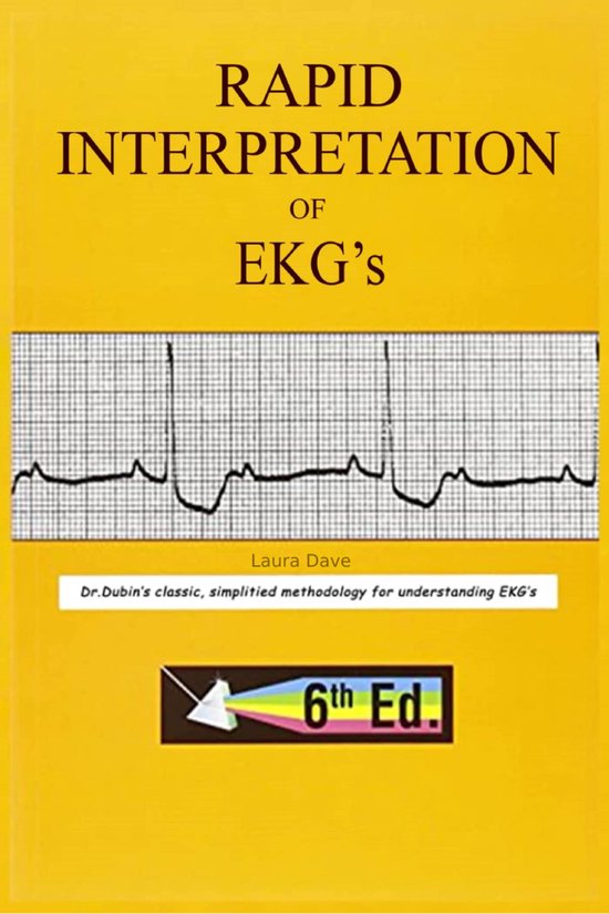 EKG/ECG Interpretation: Everything you Need to Know about the 12 - Lead ECG/EKG... | bol