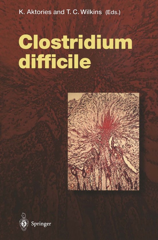 Clostridium difficile | 9783540672913 | Klaus Aktories, Tracy D ...