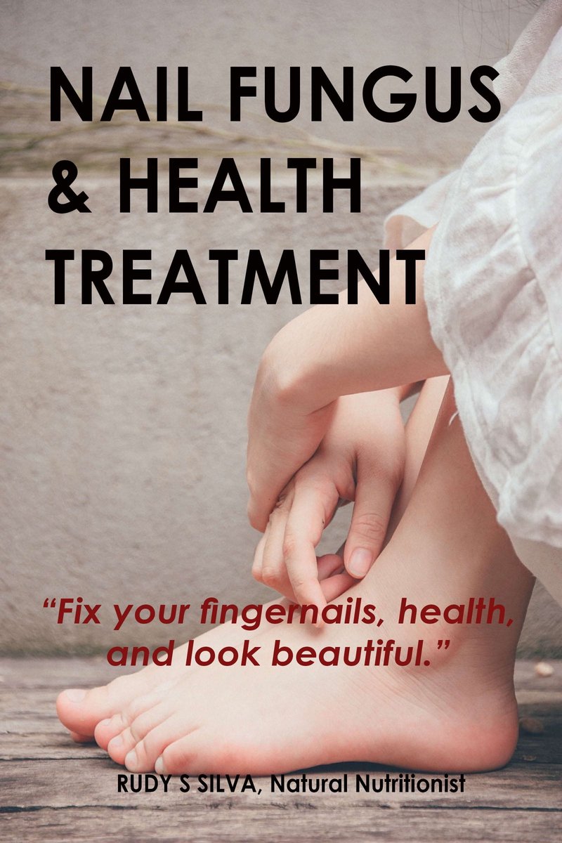 Nail Fungus And Health Treatment Ebook Rudy Silva 1230005990894