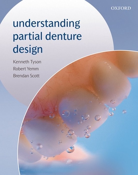 Understanding Partial Denture Design | 9780198510925 | Kenneth Tyson ...