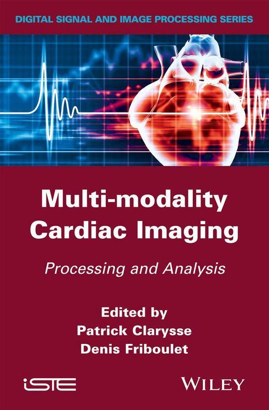 Multi-modality Cardiac Imaging (ebook), P Clarysse | 9781118574461 | Boeken | bol.com
