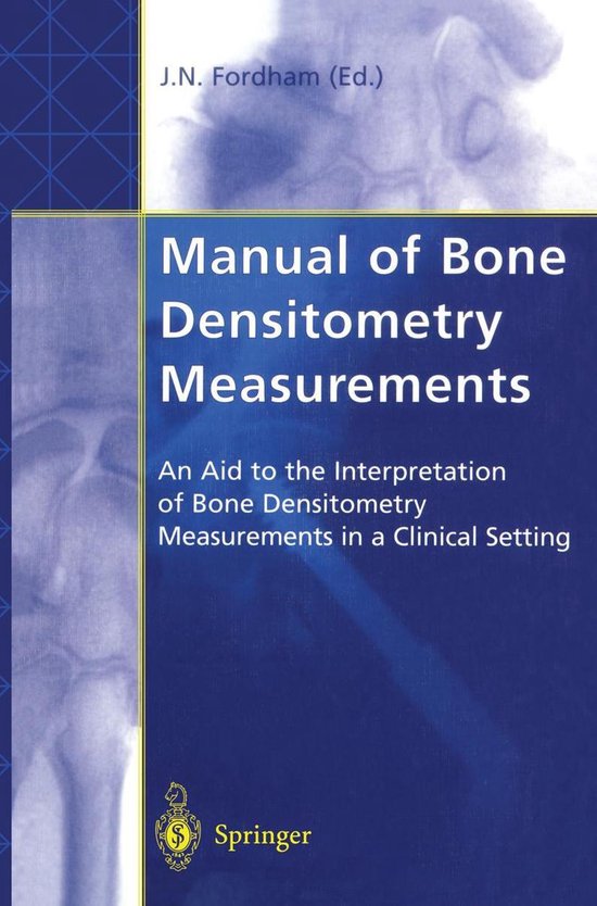 Manual of Bone Densitometry Measurements (ebook), John N. Fordham ...